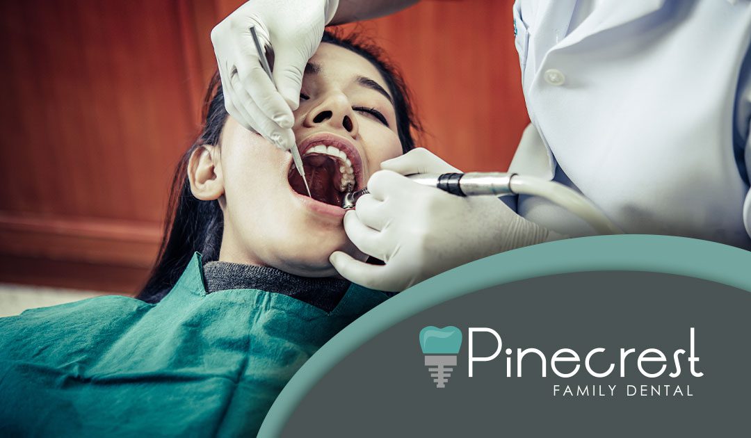 Root Canal: A Path to Dental Wellness | Pinecrest Family Dental